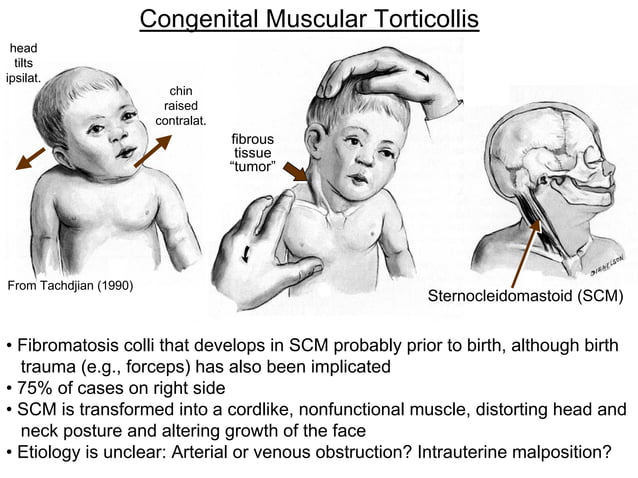 Peds ortho-anatomy | PDF