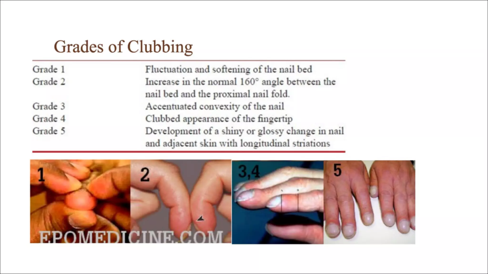 Pediatrics - Pulse Oximetry and Clubbing (concise) | PDF
