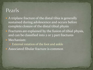 Triplane Fracture | PPTX