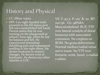 Lateral Humeral Condyle Fracture | PPTX