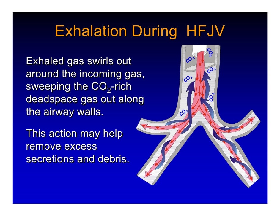 High Frequency Ventillation