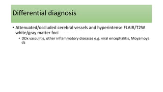 Pediatric vasculitis | PPTX