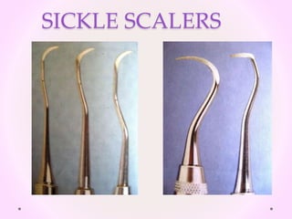 periodontal instruments and their uses | PPTX