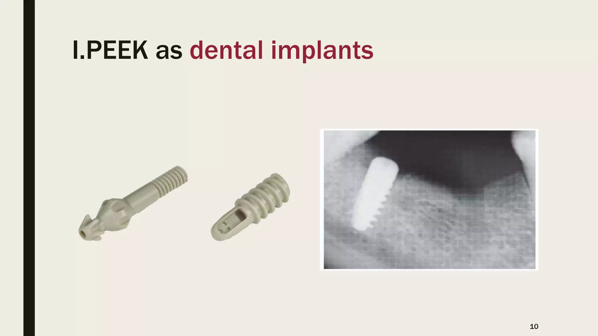 PEEK :Polyetheretherketone applications in clinical dentistry | PPTX