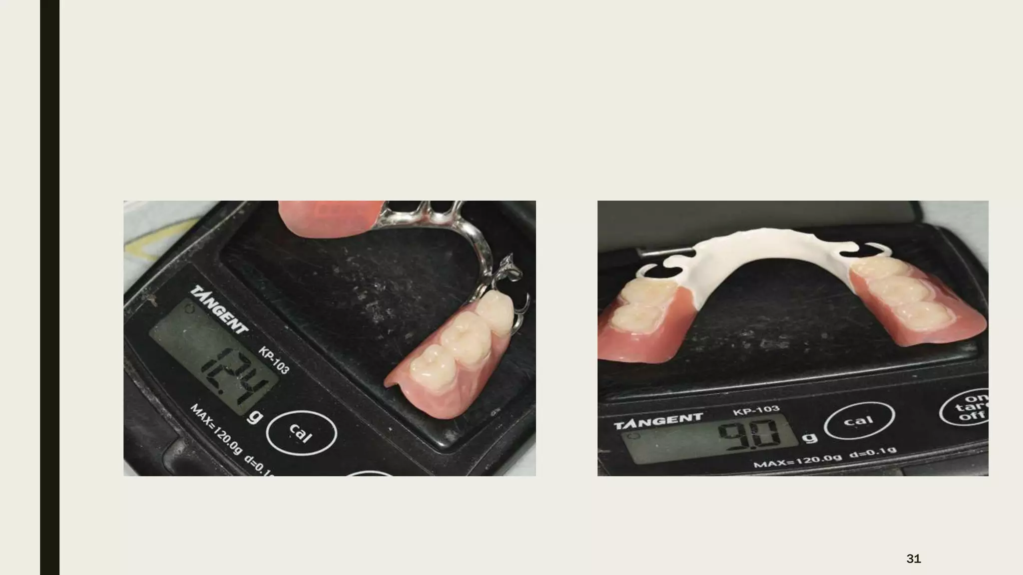 PEEK :Polyetheretherketone applications in clinical dentistry | PPTX