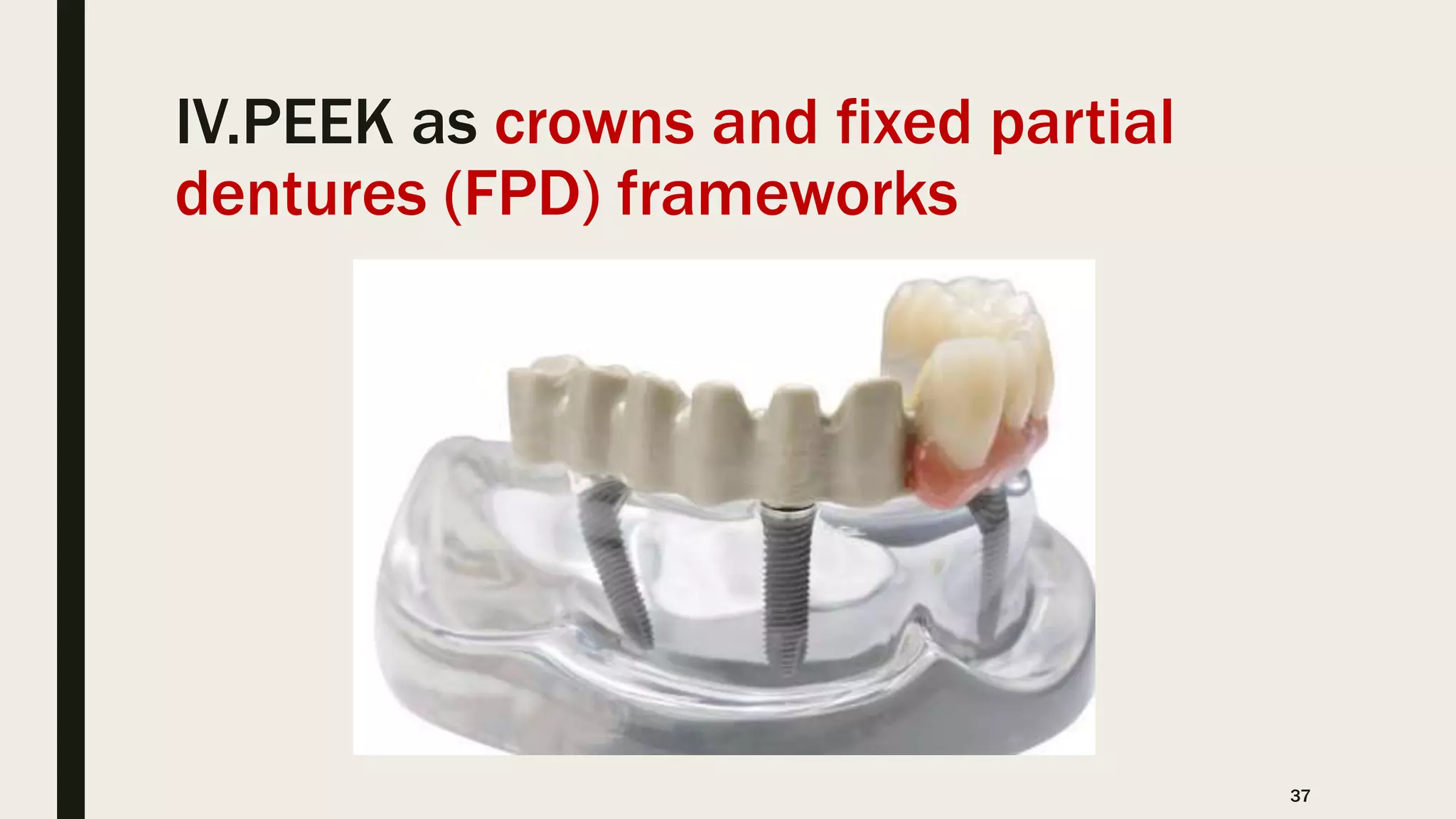 PEEK :Polyetheretherketone applications in clinical dentistry | PPTX