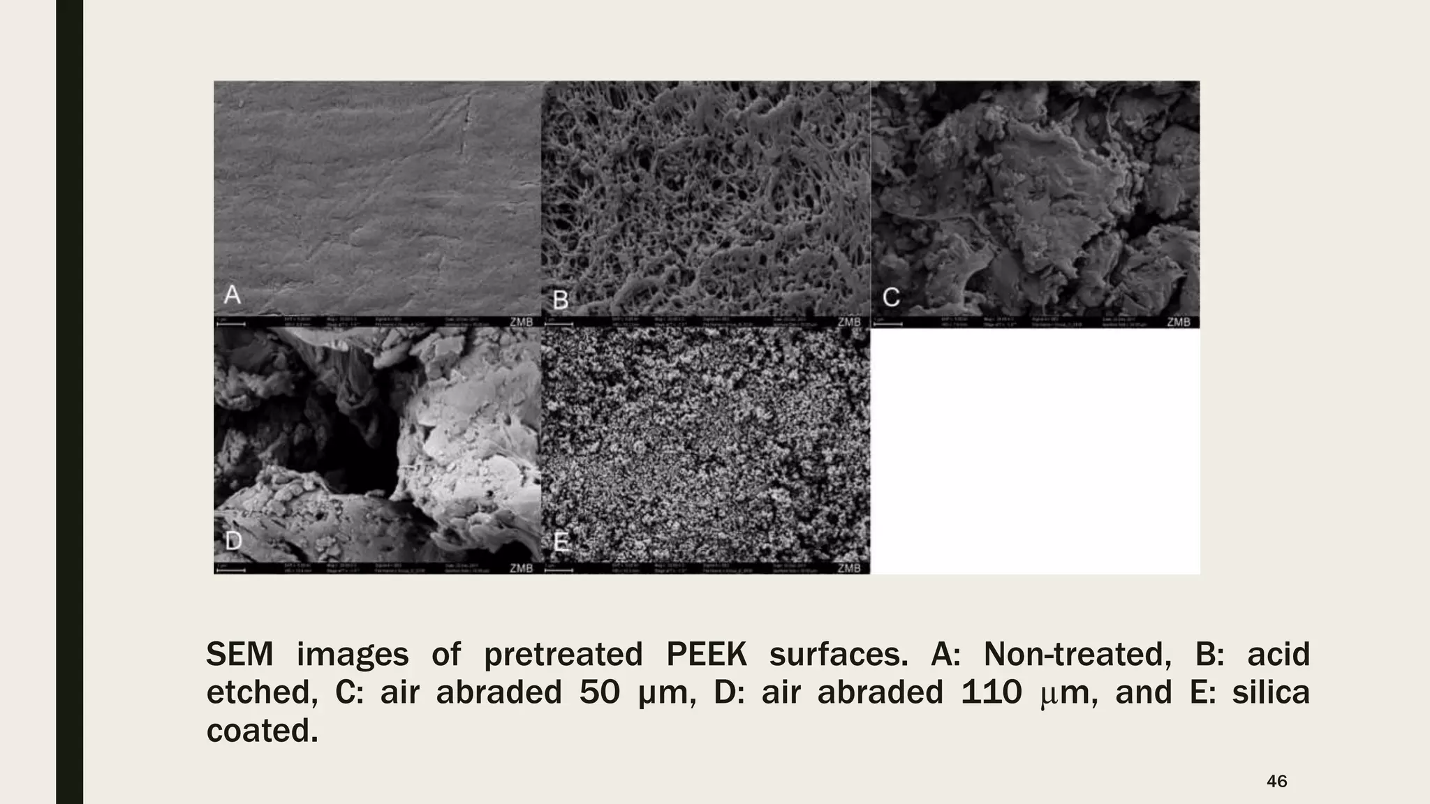 PEEK :Polyetheretherketone applications in clinical dentistry | PPTX