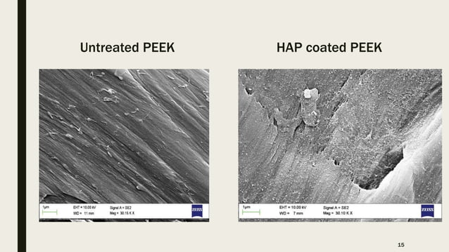 PEEK :Polyetheretherketone applications in clinical dentistry | PPTX