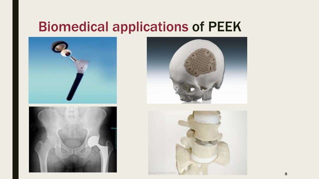 PEEK :Polyetheretherketone applications in clinical dentistry | PPTX