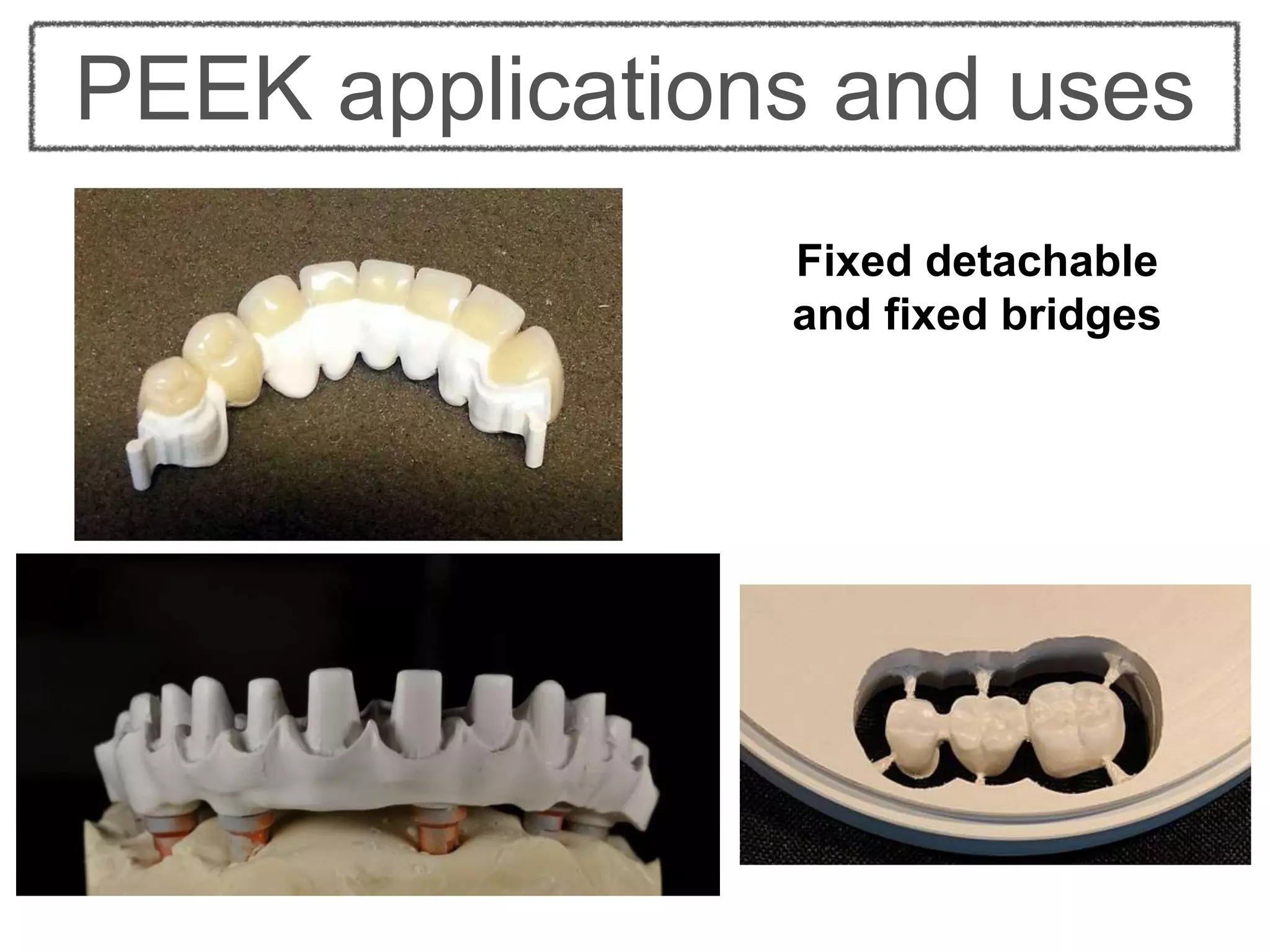 Peek material as an option in managing difficult implants positions and angulation (modified) | PPTX
