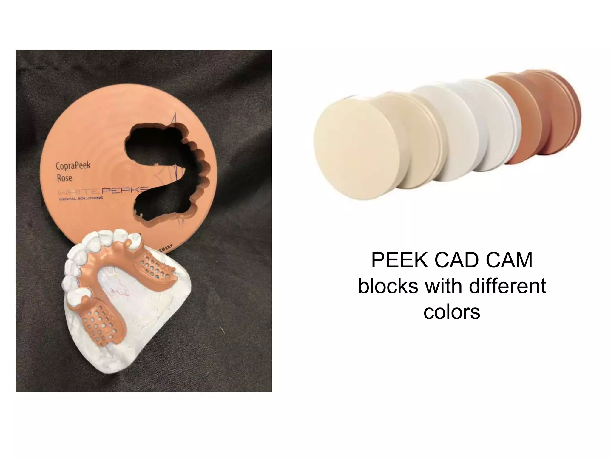 Peek material as an option in managing difficult implants positions and angulation (modified) | PPTX