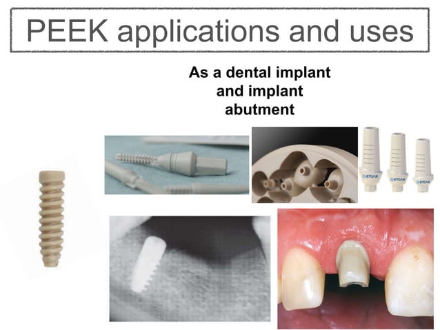 Peek material as an option in managing difficult implants positions and angulation (modified) | PPTX