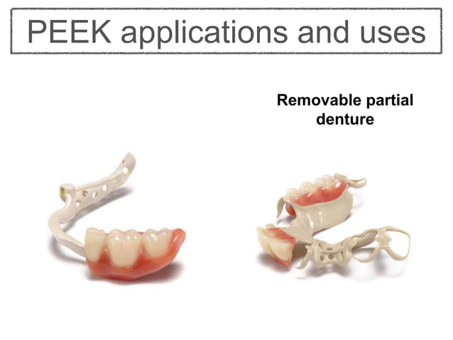 Peek material as an option in managing difficult implants positions and ...