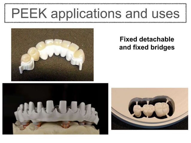 Peek material as an option in managing difficult implants positions and ...
