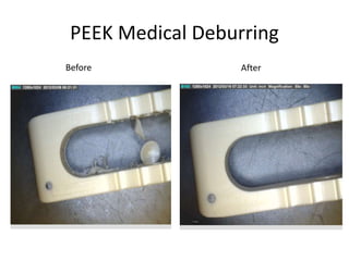Peek medical deburring | PPTX
