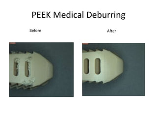 Peek medical deburring | PPTX | Medical Health