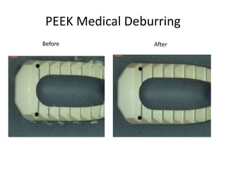 Peek medical deburring | PPTX