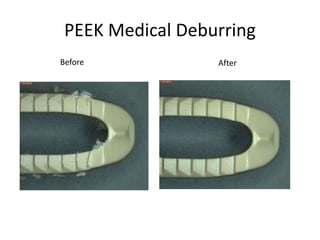 Peek medical deburring | PPTX | Medical Health