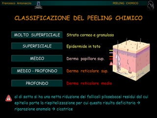 Peeling chimico: concetti generali e tecnica | PPTX