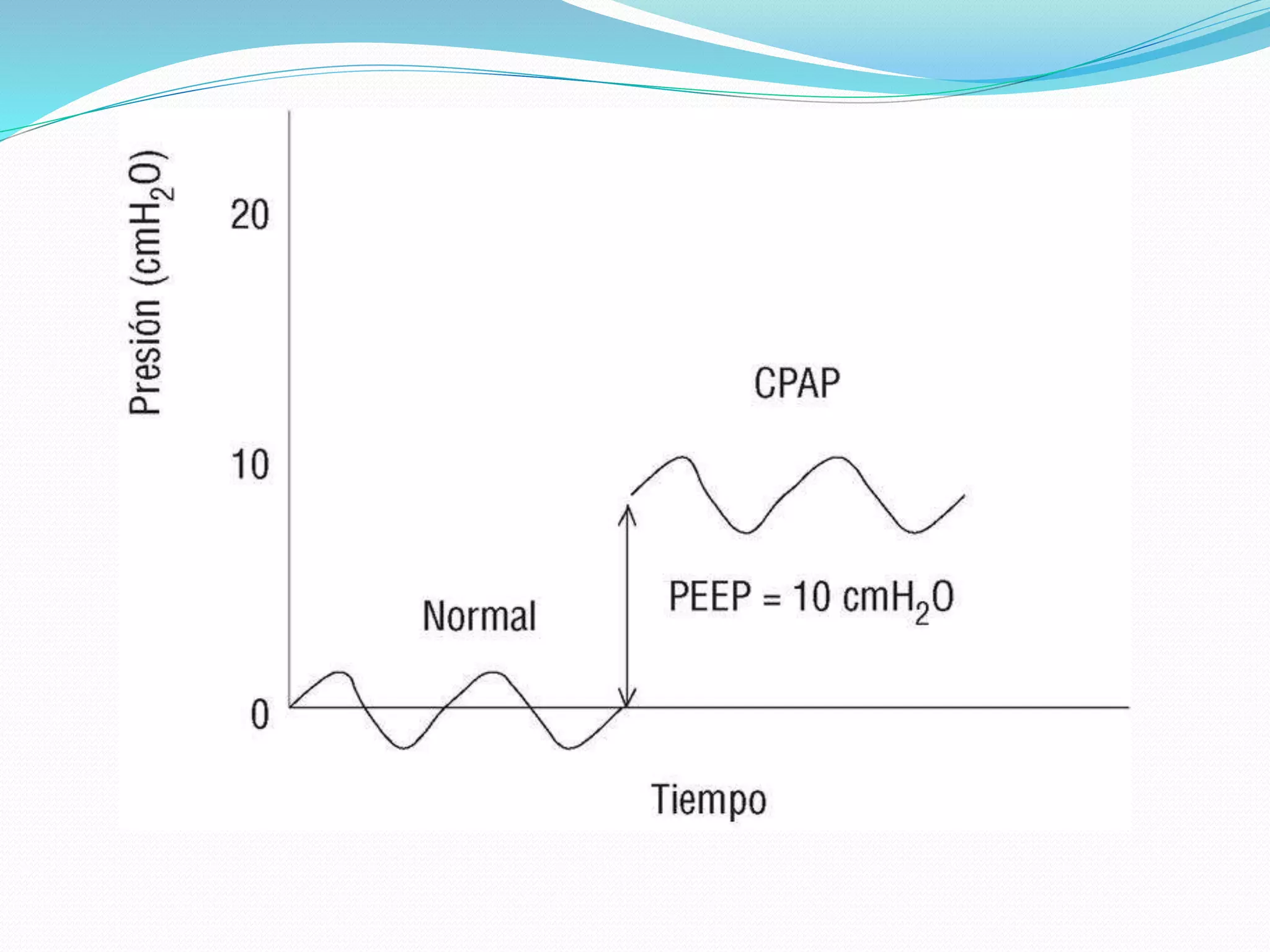 Peep & cpap | PPTX