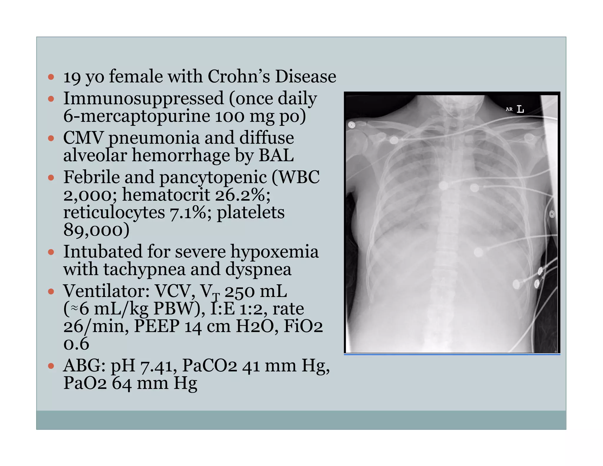 PEEP:Bring the Evidence to the Bedside | PDF
