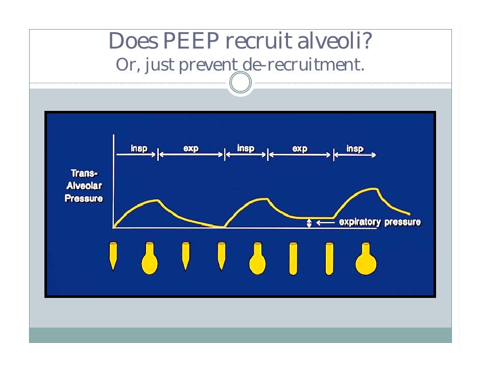 PEEP:Bring the Evidence to the Bedside