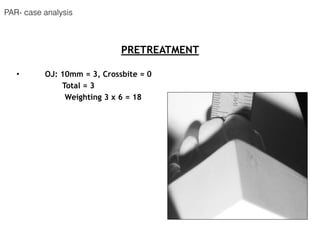 Peer Assessment Rating (PAR) - Orthodontic Index | PDF