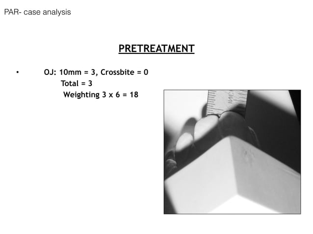 Peer Assessment Rating Par Orthodontic Index Pdf