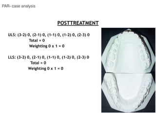Peer Assessment Rating (PAR) - Orthodontic Index | PDF