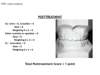 Peer Assessment Rating (PAR) - Orthodontic Index | PDF