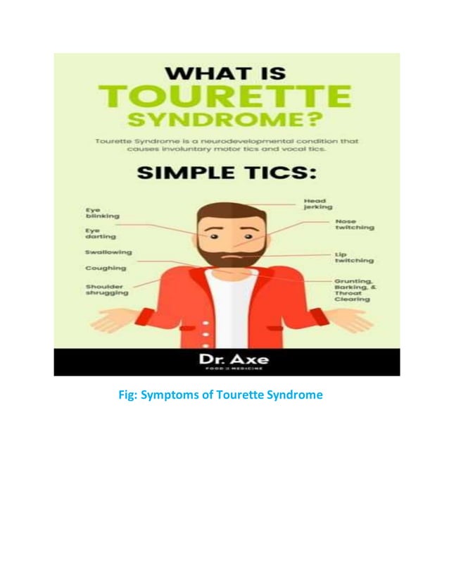 Peer graded assignment | DOCX