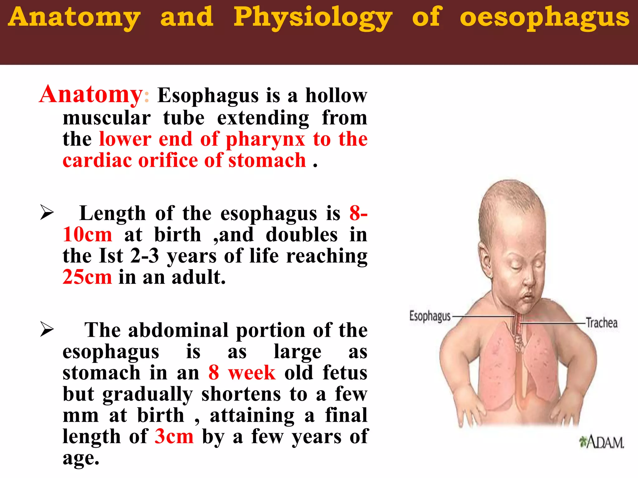 Esophageal Atresia (EA) and Tracheo Esophageal Fistula (TEF) | PPTX