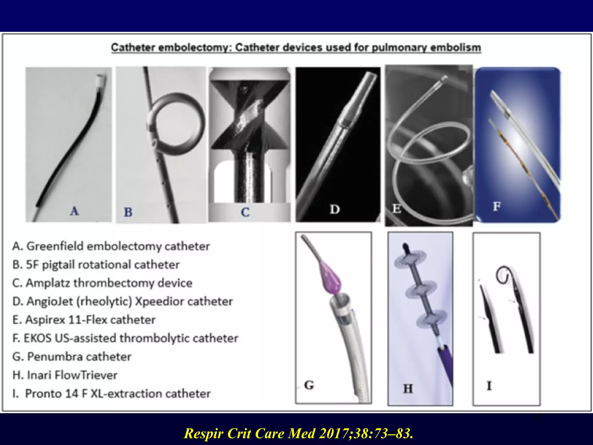 catheter based management of pulmonary embolism | PPT