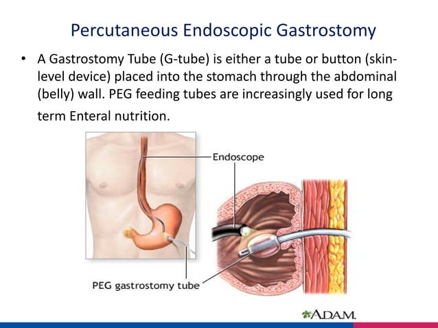 Peg | PDF | First Aid | Injuries