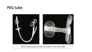 Percutaneous Endoscopic Gastrostomy: Complications & Risk Factors.pptx