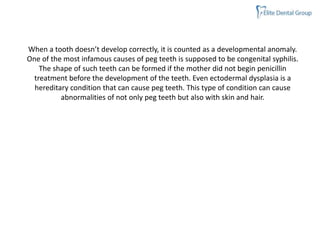 PEGGED TEETH- MEANING, CAUSES AND TREATMENT | PPTX
