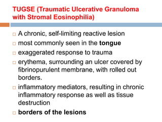 Pseudoepithelial hyperplasia | PPT