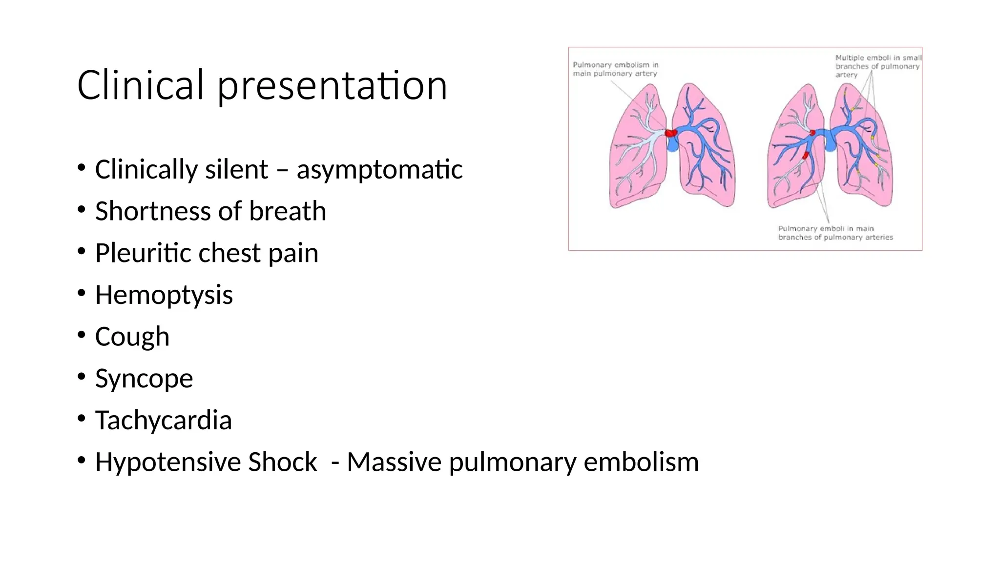 Pulmonary Embolism in children done by a Postgraduate student | PPTX