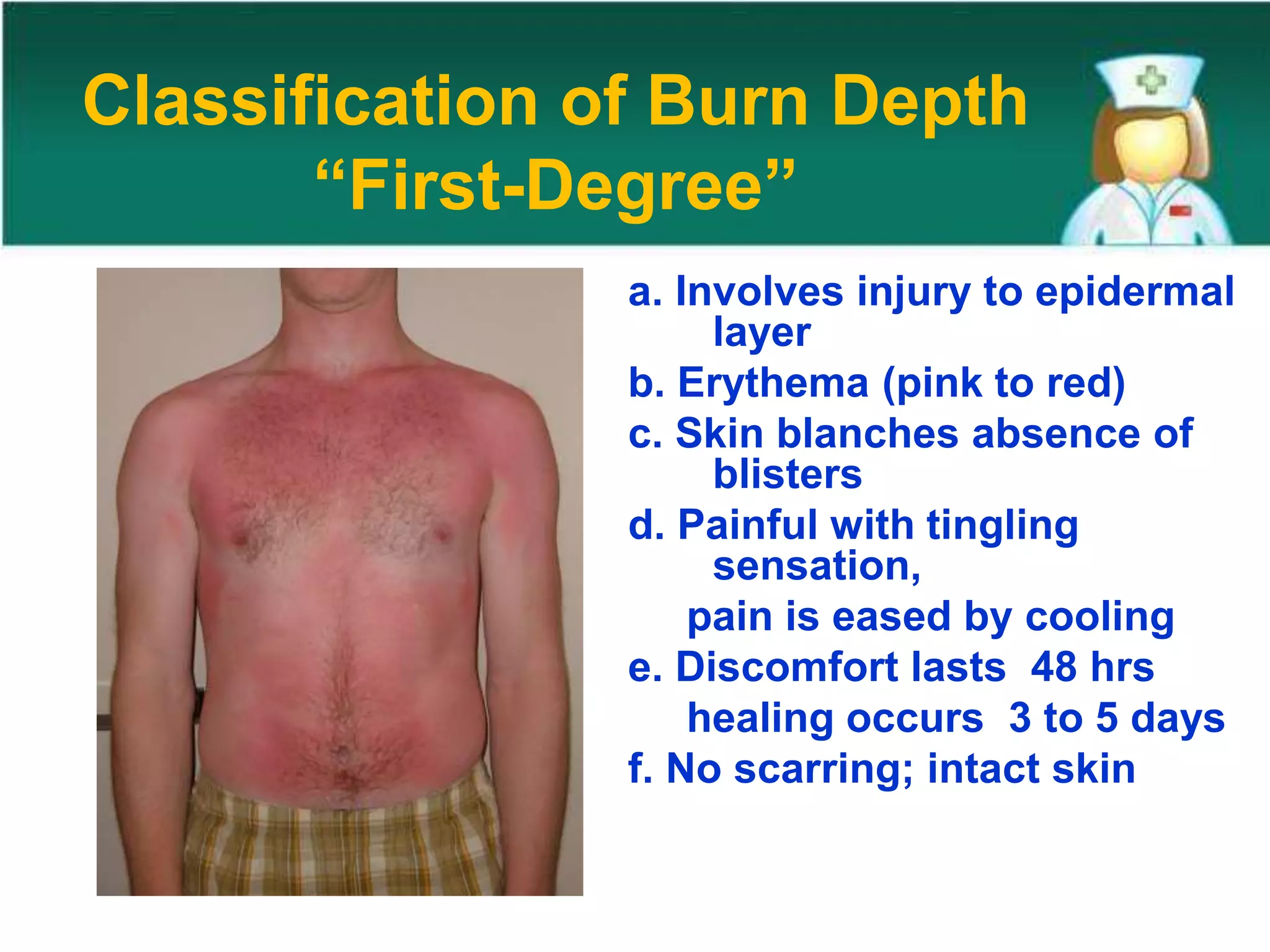 Peioperative Anaesthesia Management of Burn Patients.pptx