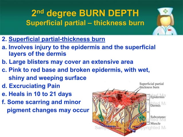 Peioperative Anaesthesia Management of Burn Patients.pptx | First Aid ...