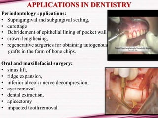 Peizosurgery: A boon in modern periodontics | PPTX