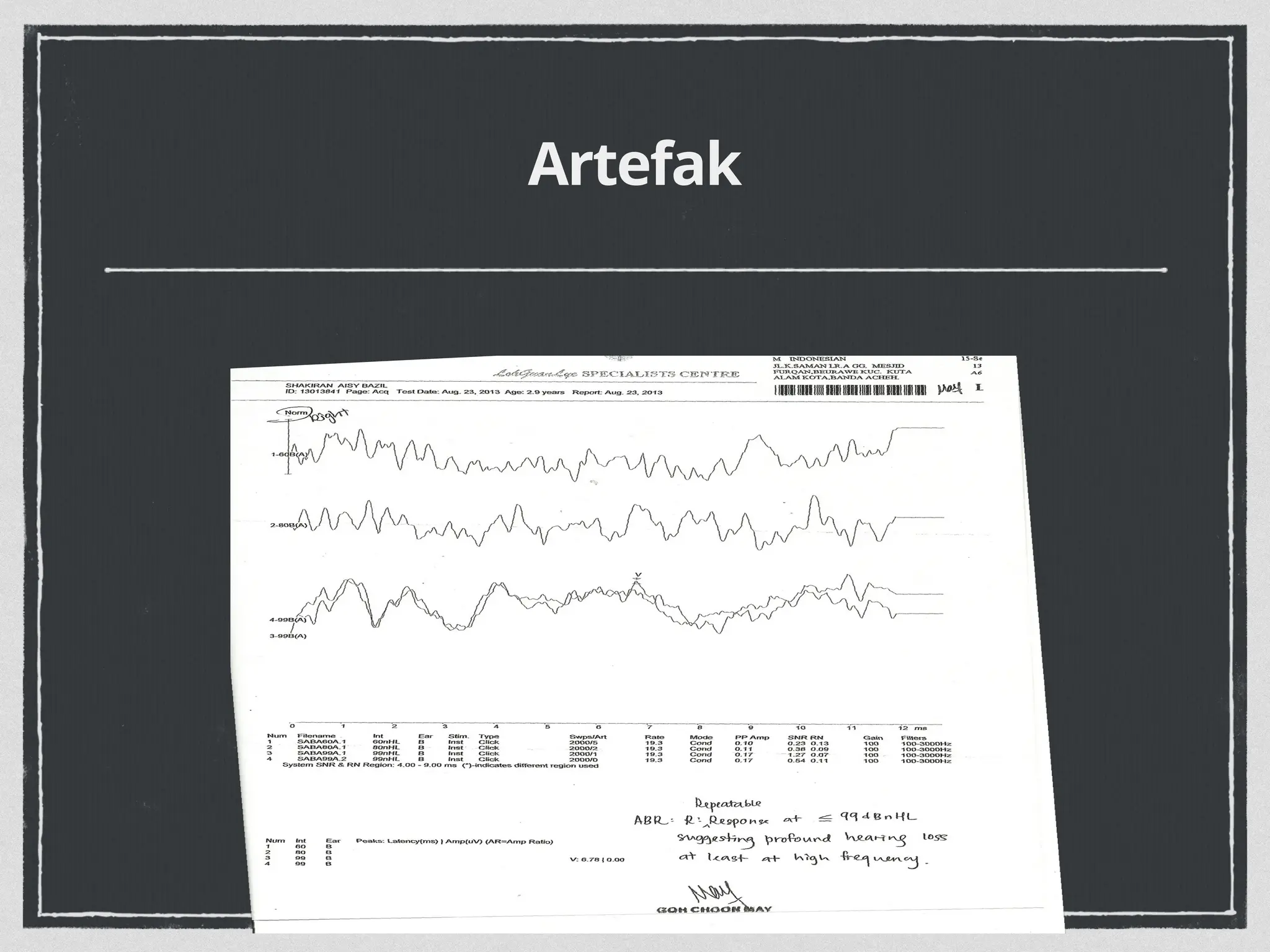 Pelatihan BERA ASSR Natus [Autosaved].pptx