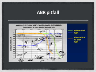 Pelatihan BERA ASSR Natus [Autosaved].pptx