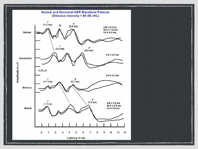 Pelatihan BERA ASSR Natus [Autosaved].pptx