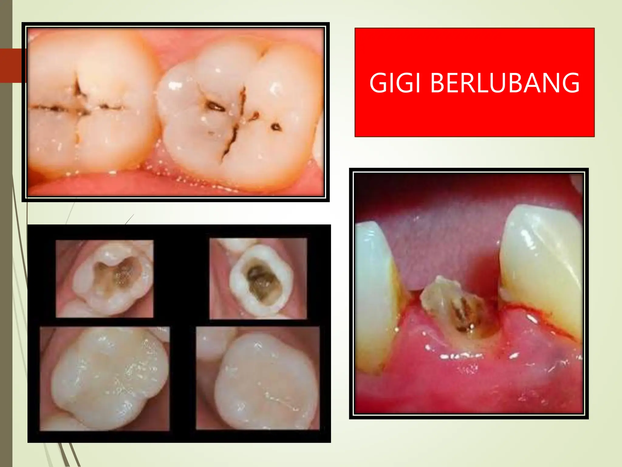 PELATIHAN BAGI KADER KESEHATAN GIGI.pptx