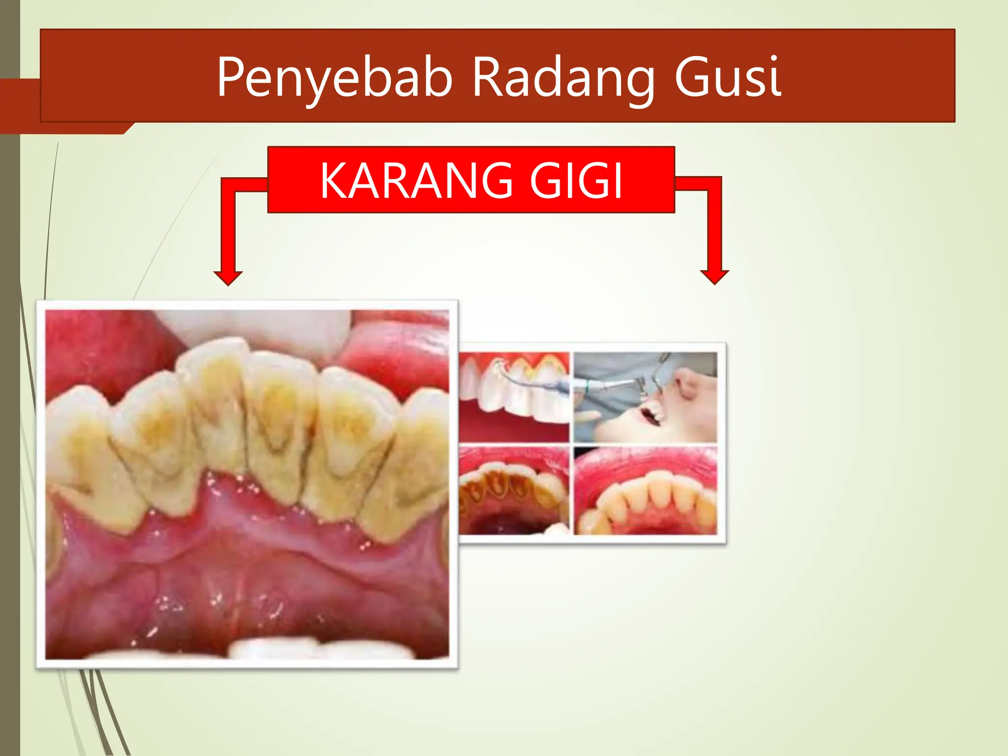 PELATIHAN BAGI KADER KESEHATAN GIGI.pptx