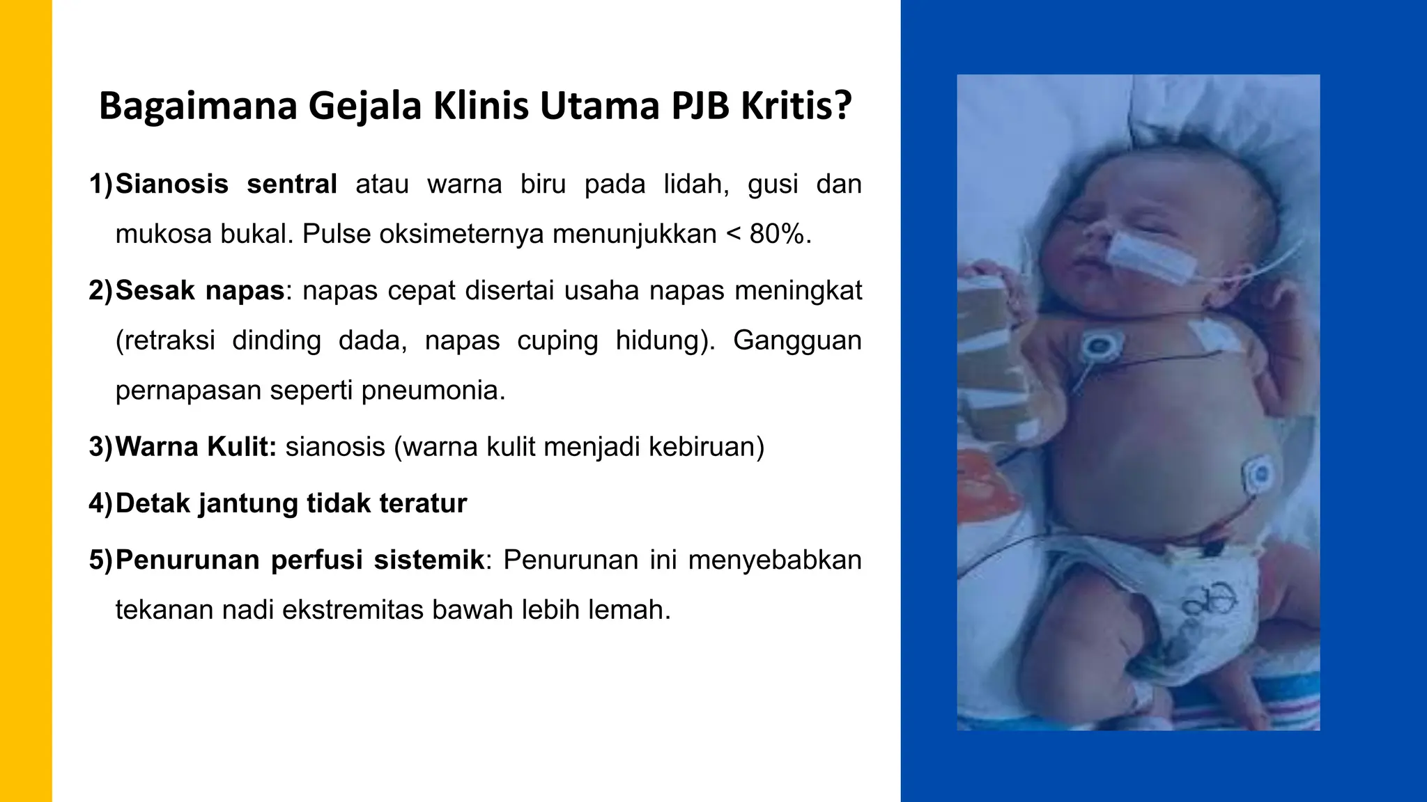 Pelatihan PJB dan SHK untuk ibu nifas dan bayi baru lahir di puskesmas.pptx