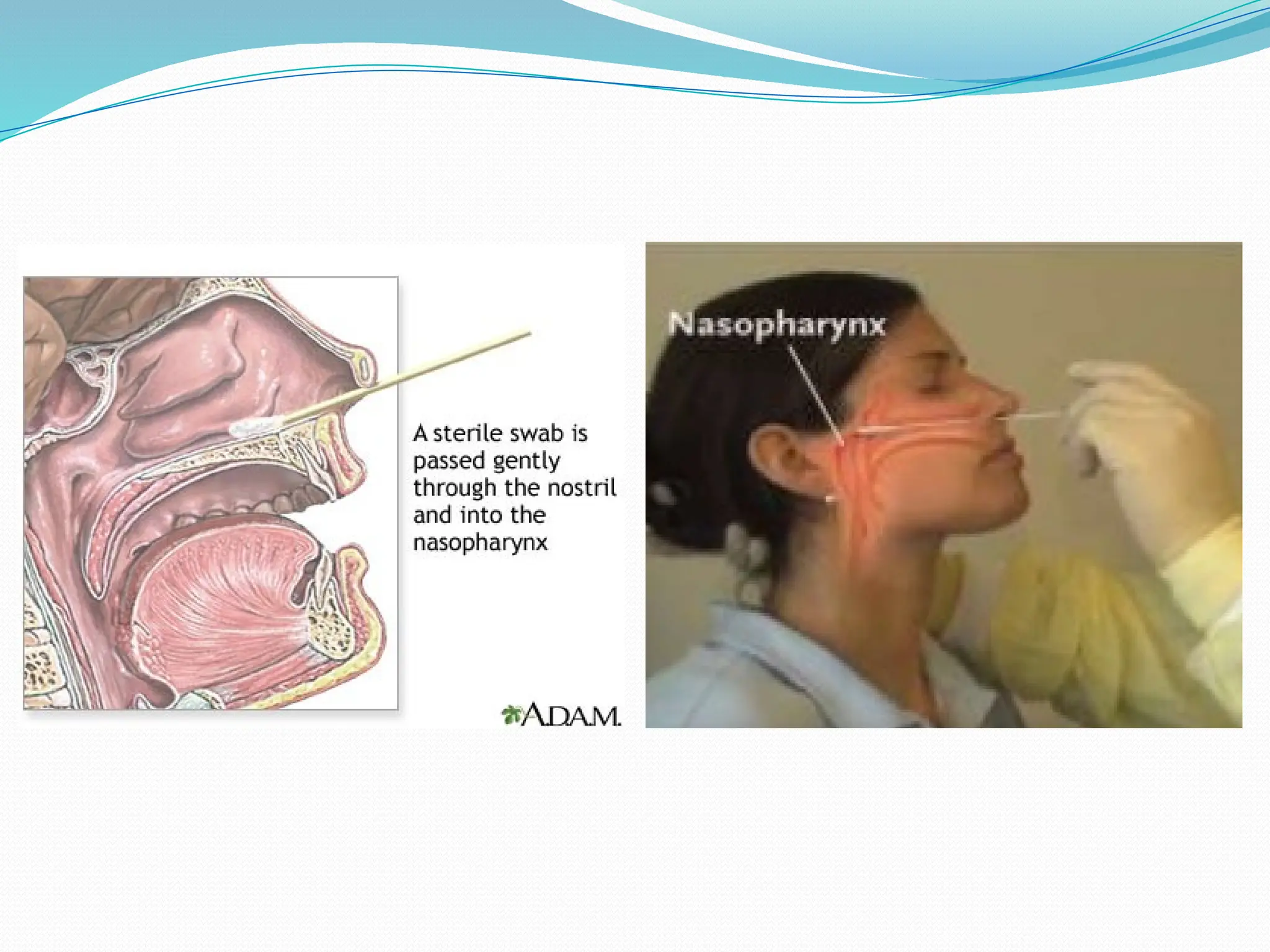 Pelatihan swab nasofaring dan orofaring yang benar | PPTX