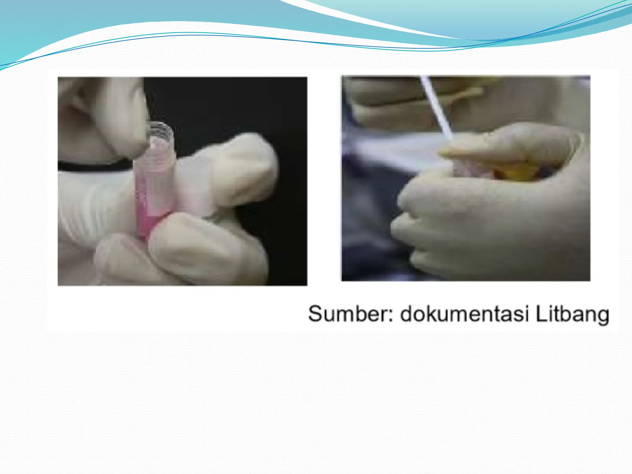 Pelatihan swab nasofaring dan orofaring yang benar | PPTX