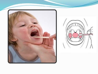 Pelatihan swab nasofaring dan orofaring yang benar | PPT